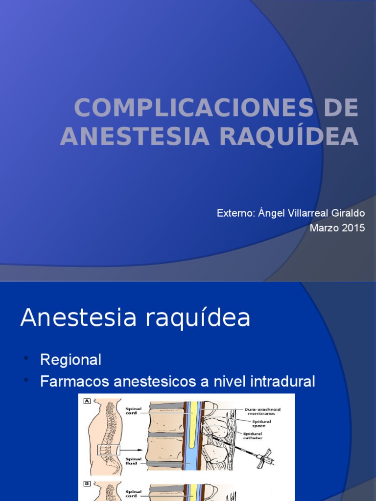COMPLICACIONES DE Anestesia Raquídea | PDF | Sensación | Síntomas y ...