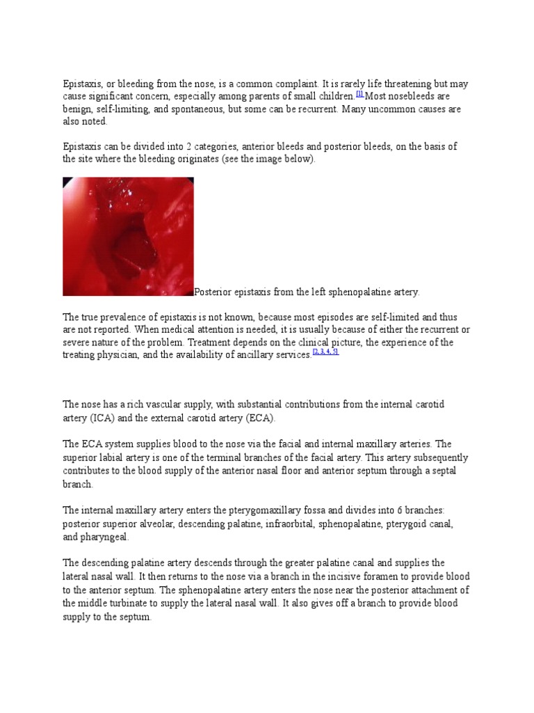 Epistaxis | Bleeding | Hypertension