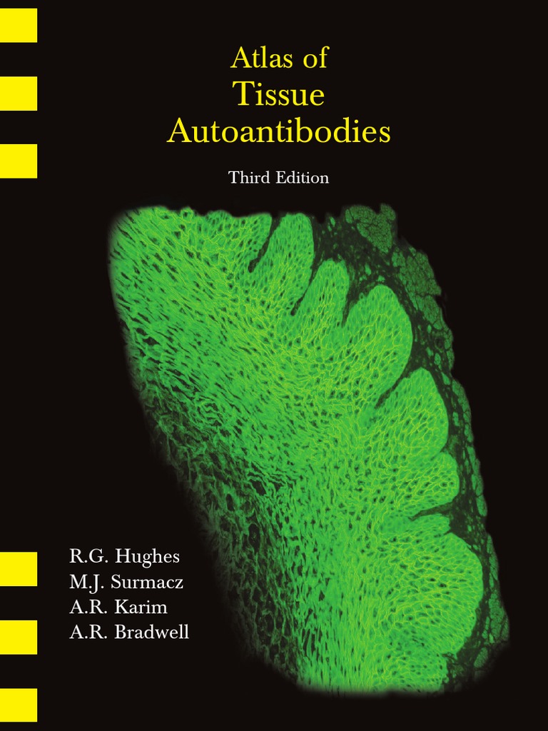 Autoantibodies | PDF | Immunohistochemistry | Immunofluorescence
