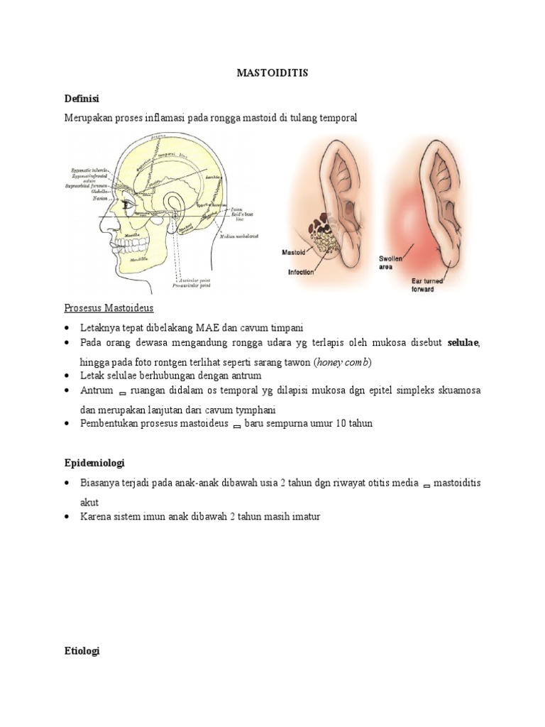 Mastoiditis | PDF | Sains & Matematika