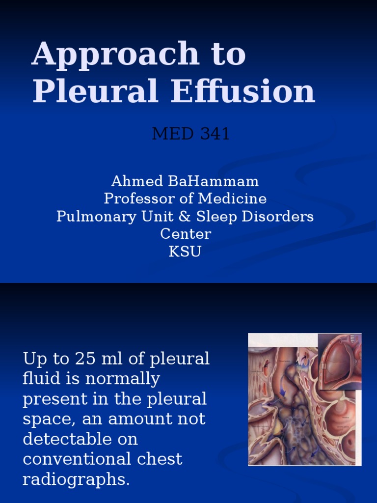 Approach To Pleural Effusion | PDF | Pulmonology | Respiratory System