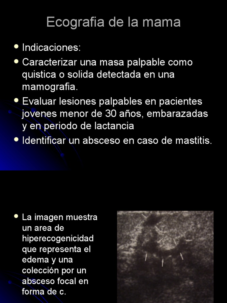 Ecografía Mamaria: Indicaciones y Hallazgos | PDF | Pecho | Ultrasonido ...