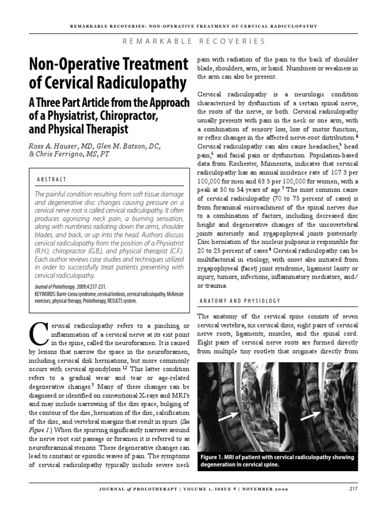 Cervical Radiculopathy | PDF | Vertebral Column | Vertebra