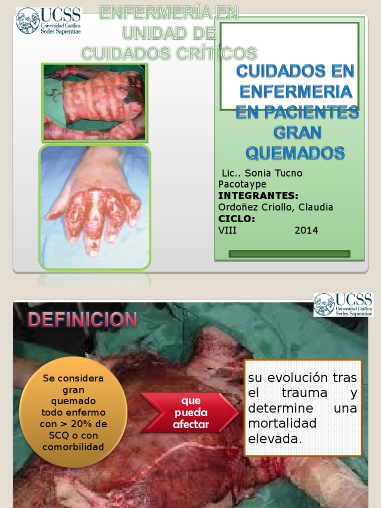 Cuidados de Enfermeria en Pacientes Gran Quemados | PDF | Quemar | Vena