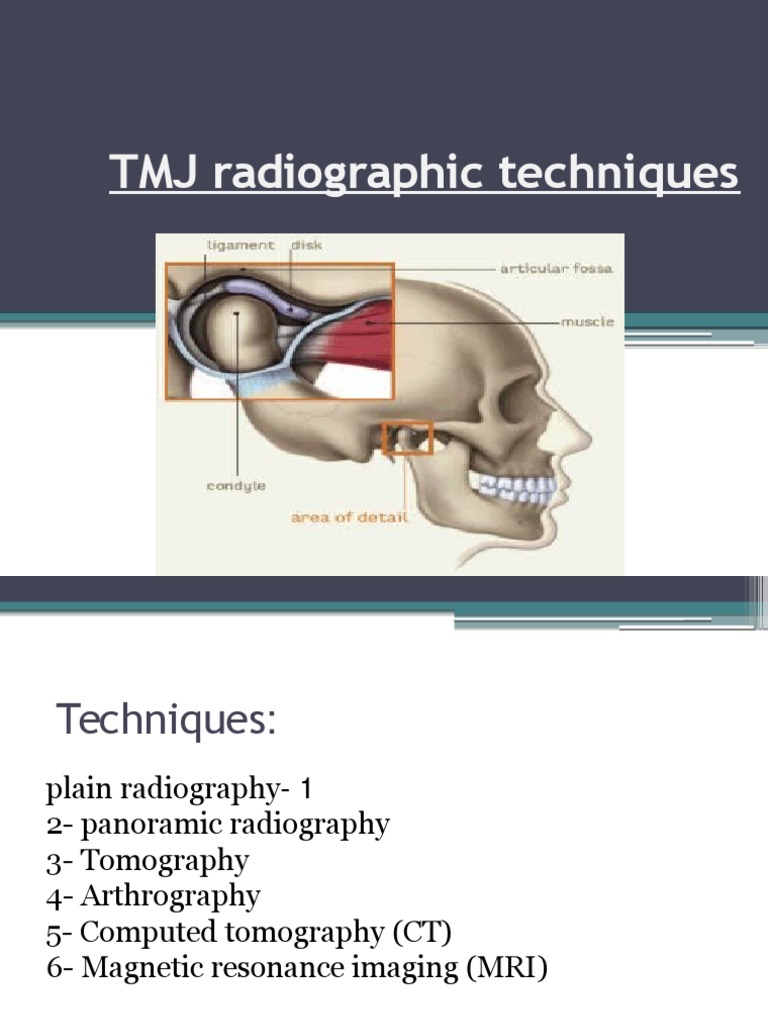 tmj imaging techniques | Ct Scan | Medical Imaging