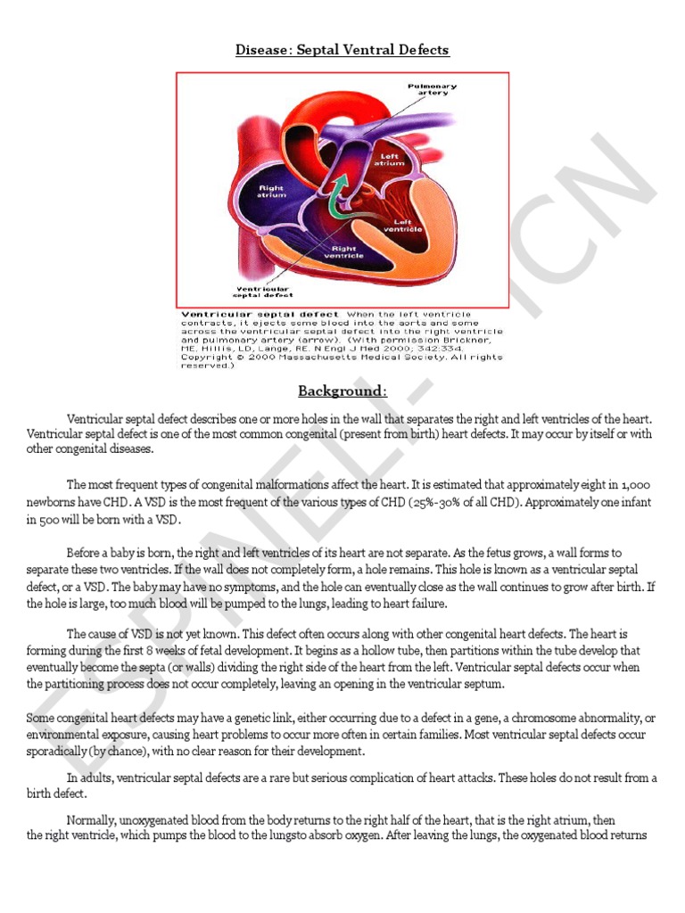 Ventricular Septal Defect | PDF | Congenital Heart Defect | Ventricle ...