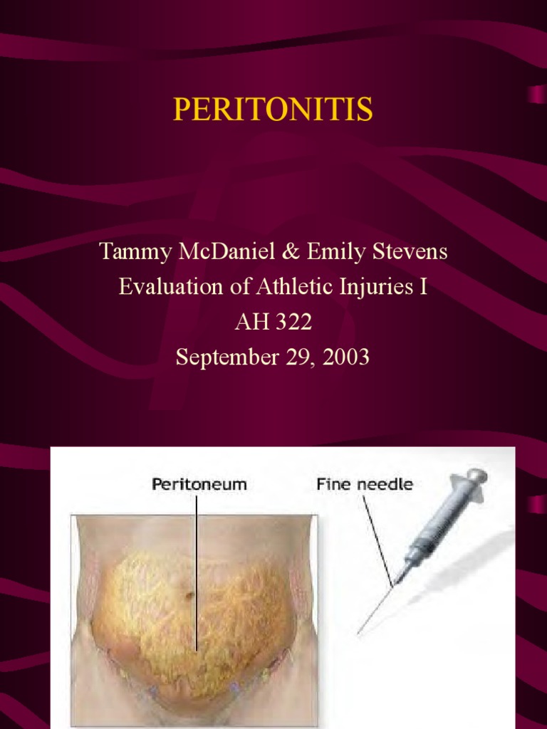 Peritonitis.ppt | Peritoneum | Abdomen