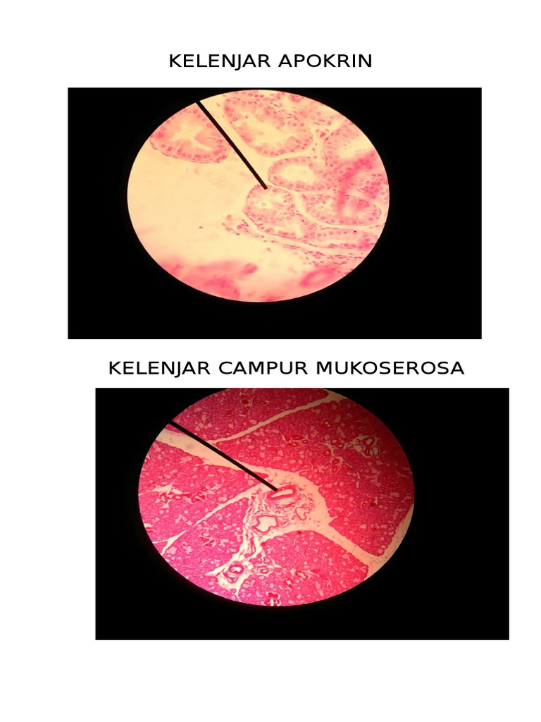 Kelenjar Apokrin | PDF
