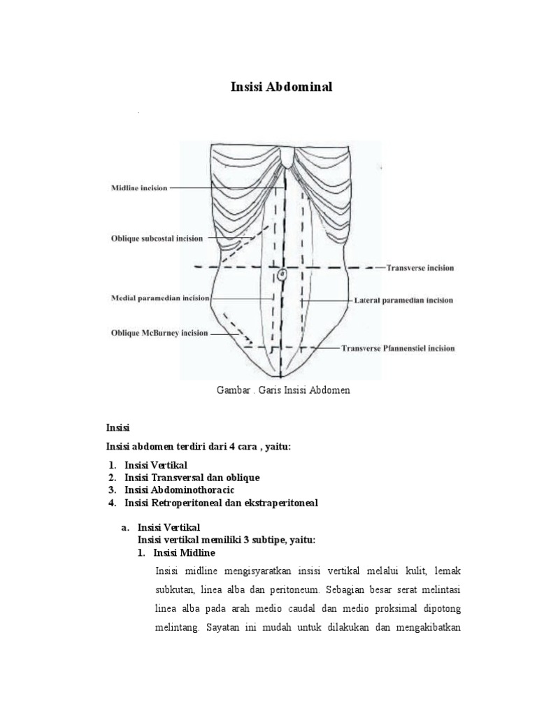 Insisi Abdominal | PDF