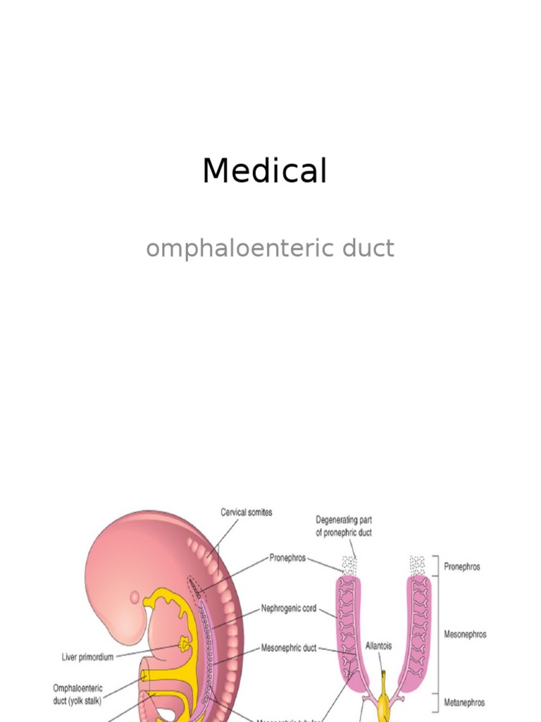 Medical: Omphaloenteric Duct | PDF