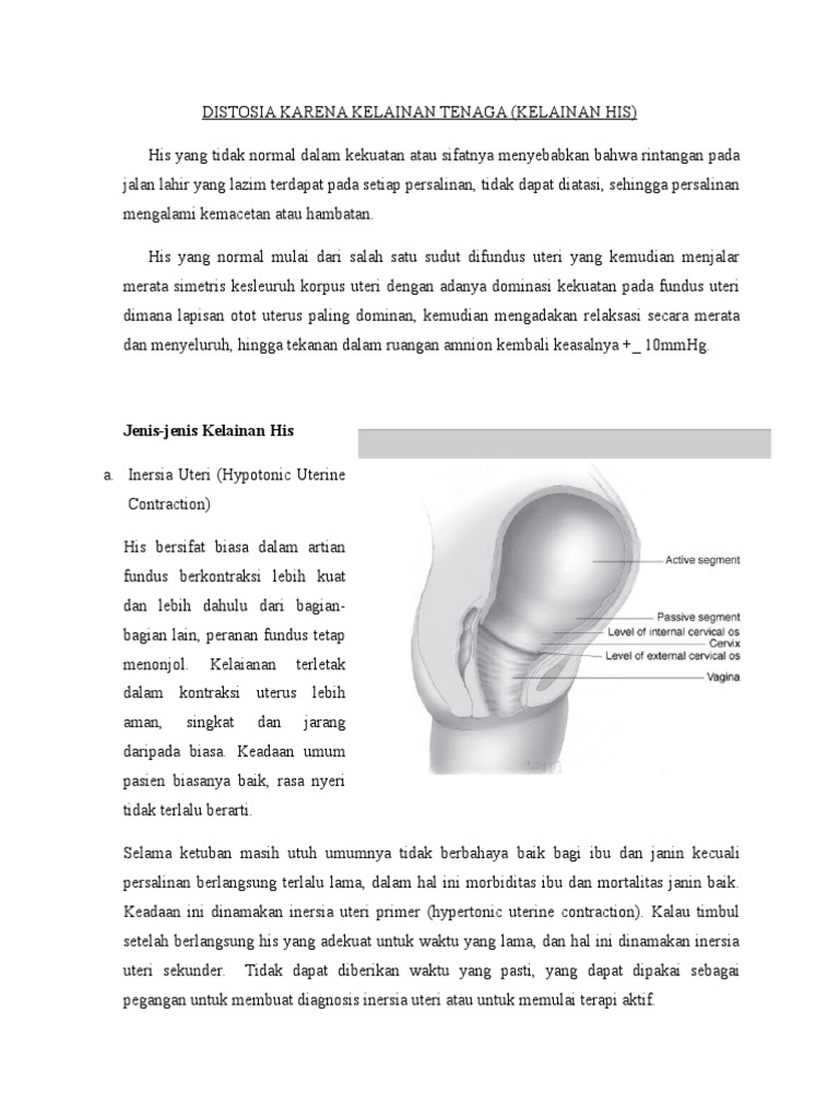 Distosia: Kelainan His dan Penanganan | PDF | Pengembangan Diri ...