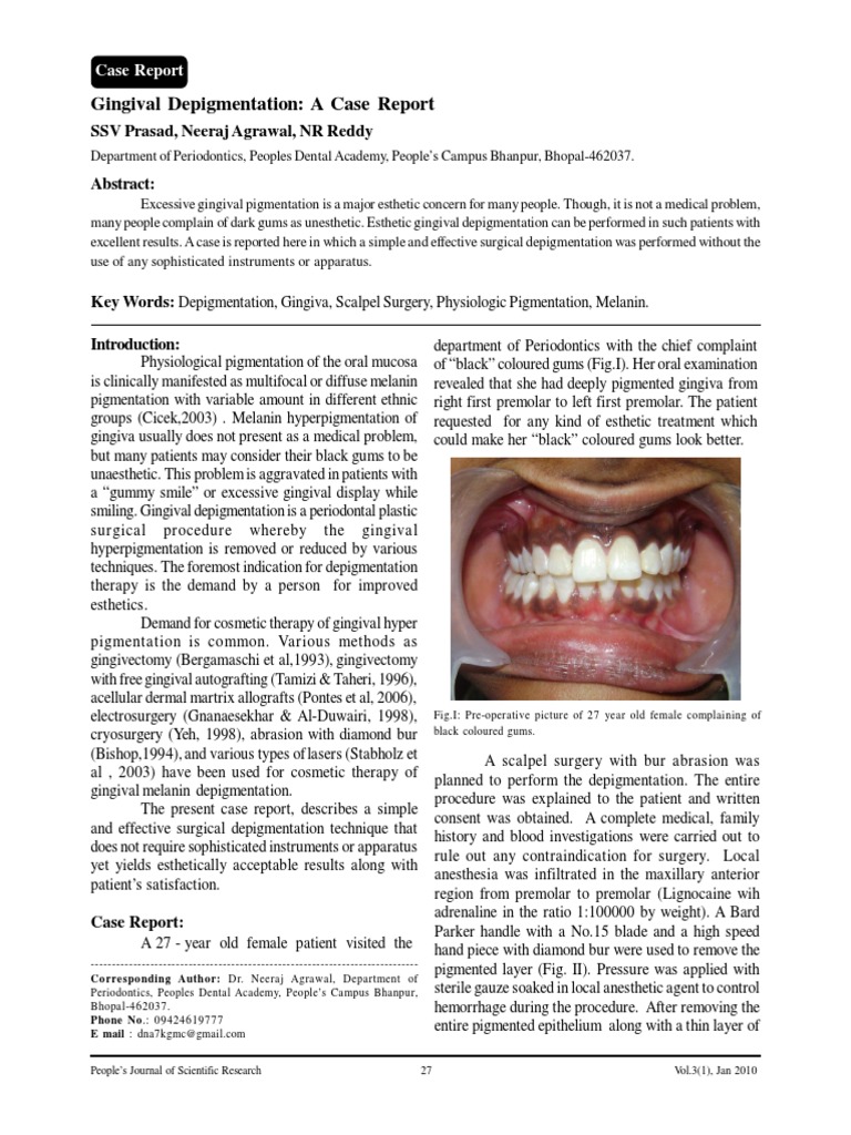 Gingival Depigmentation A Case Report | PDF | Periodontology | Clinical ...