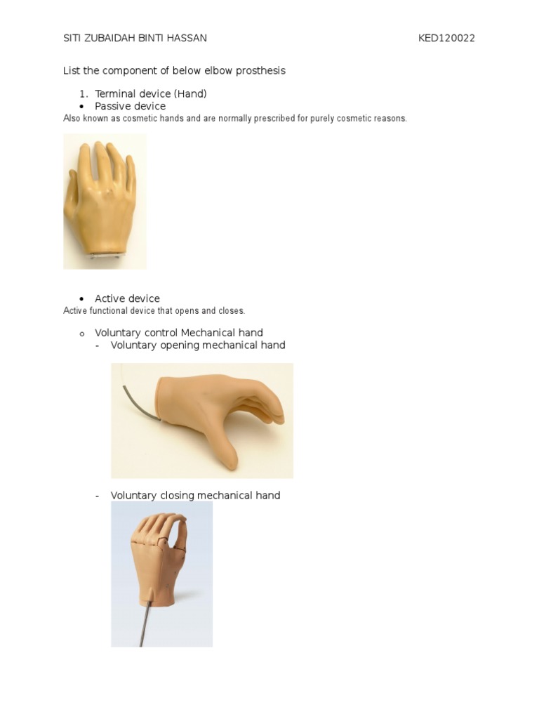 Below Elbow Prosthesis Assignment | PDF | Prosthesis | Musculoskeletal ...