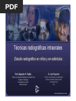 Efecto Ferula en Protesis Fija | PDF | Dentadura postiza | Boca