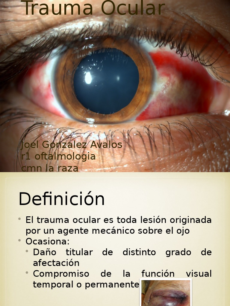 Trauma Ocular | Lesión | Ojo humano