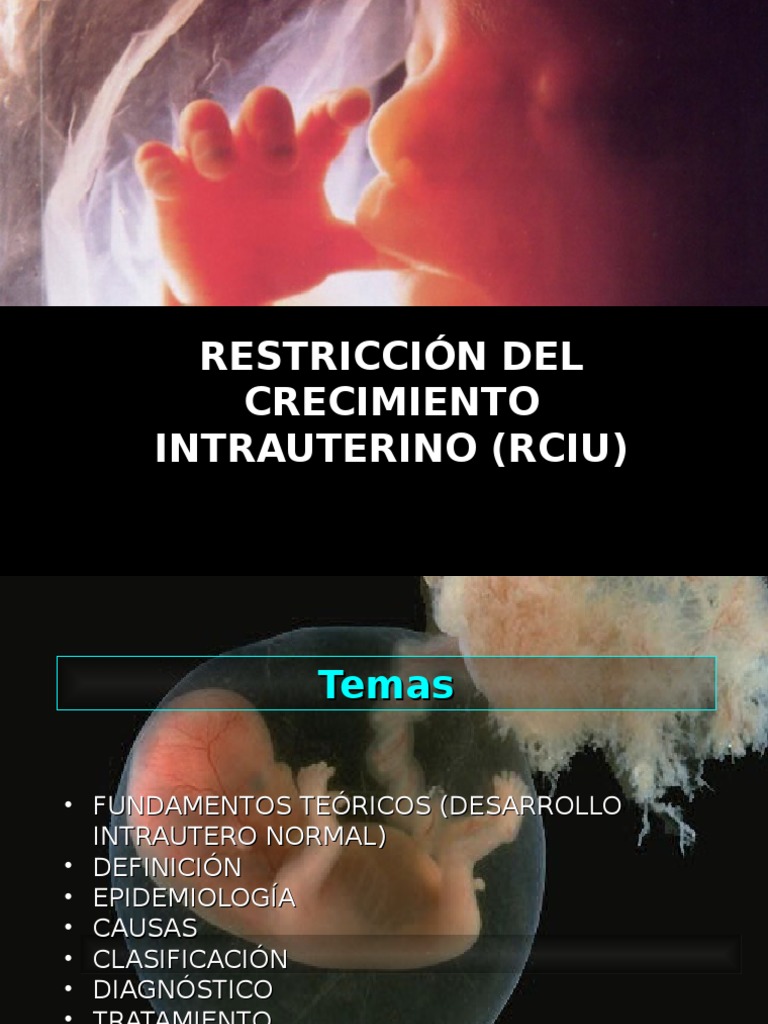Restricción del Crecimiento Fetal | PDF | El embarazo | Placenta