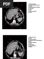 Niveles Axilares de Berg | PDF | Finanzas y dinero