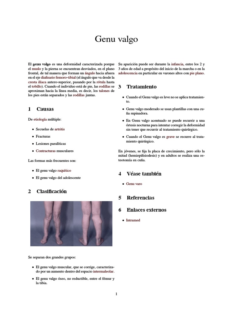 Tratamiento del Genu Valgo en Adultos | PDF | Rodilla | Ciencia de la danza