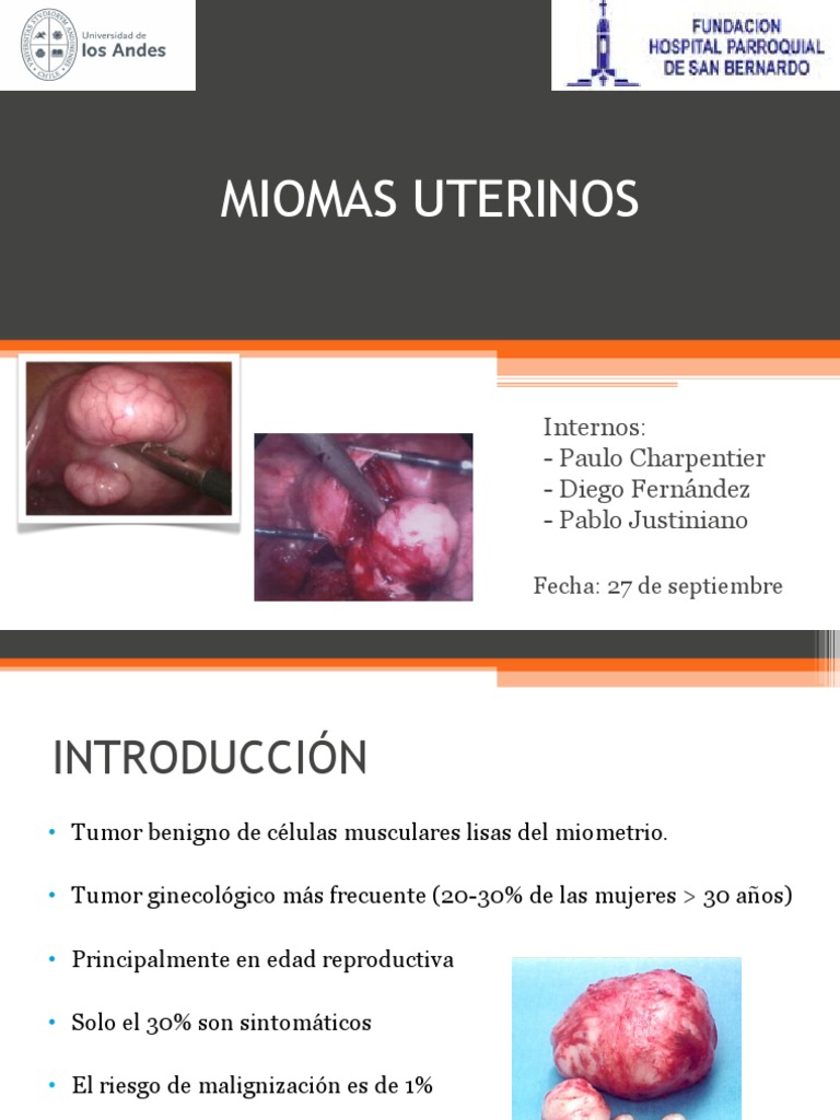 Miomas Uterinos | PDF | Anatomia sexual | Salud sexual