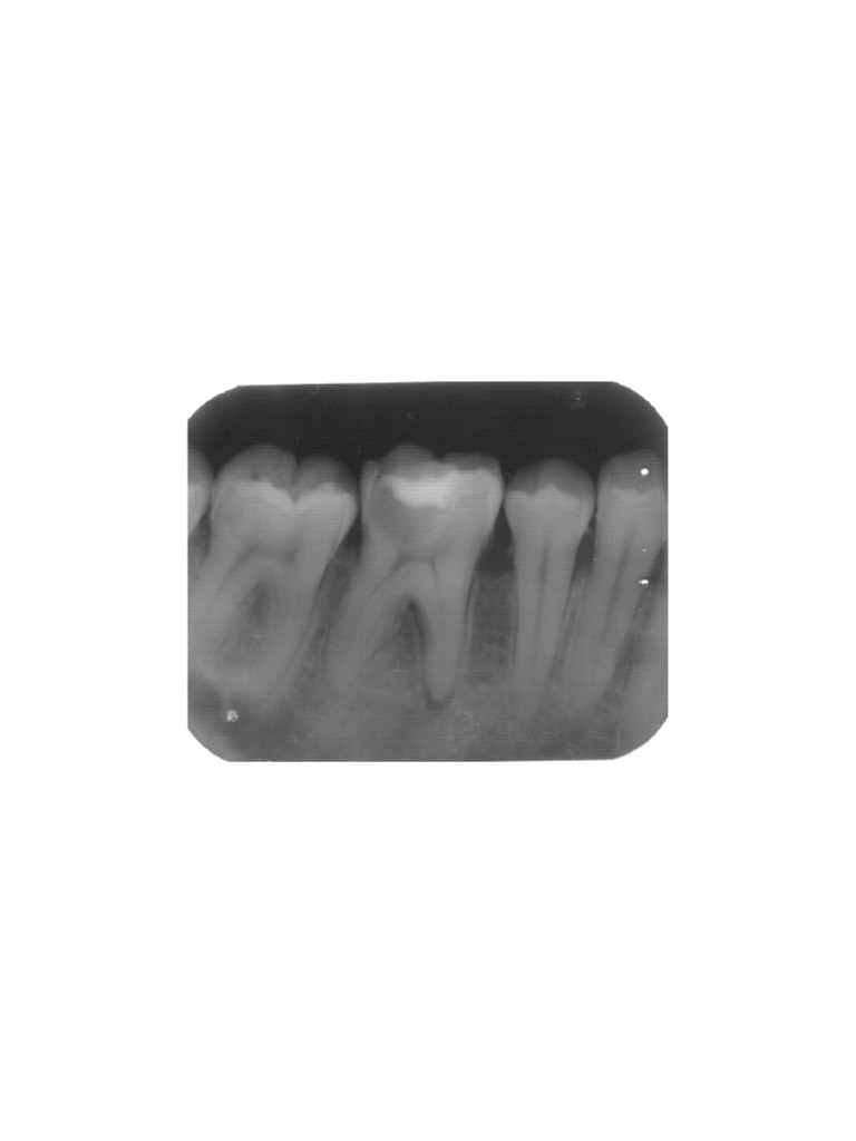 Contoh INTERPRETASI | PDF