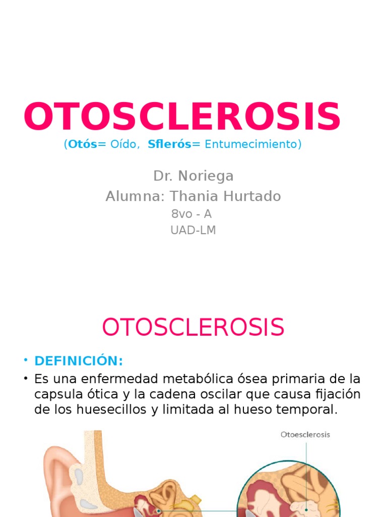 Otosclerosis | PDF | Sistema Auditorio | Escuchando