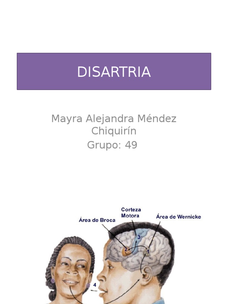 Tipos y características de las principales disartrias: una guía sobre ...