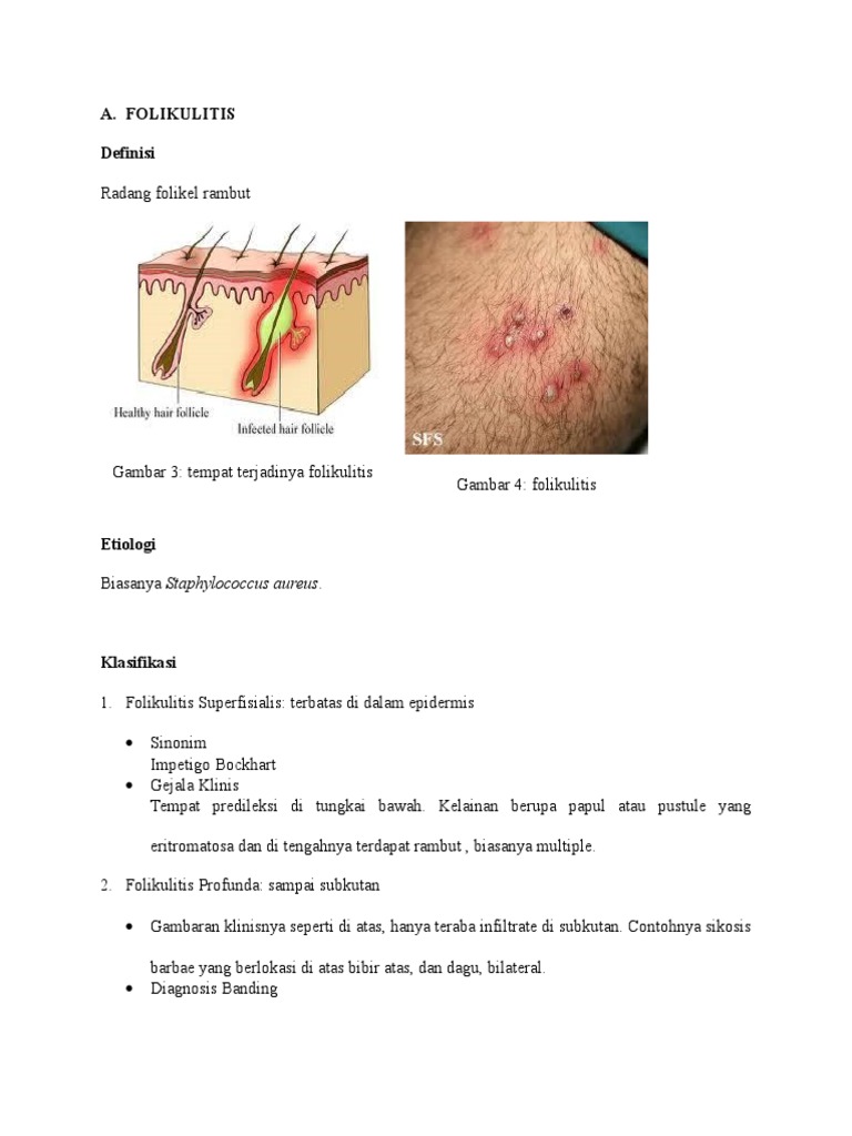 FOLIKULITIS | PDF
