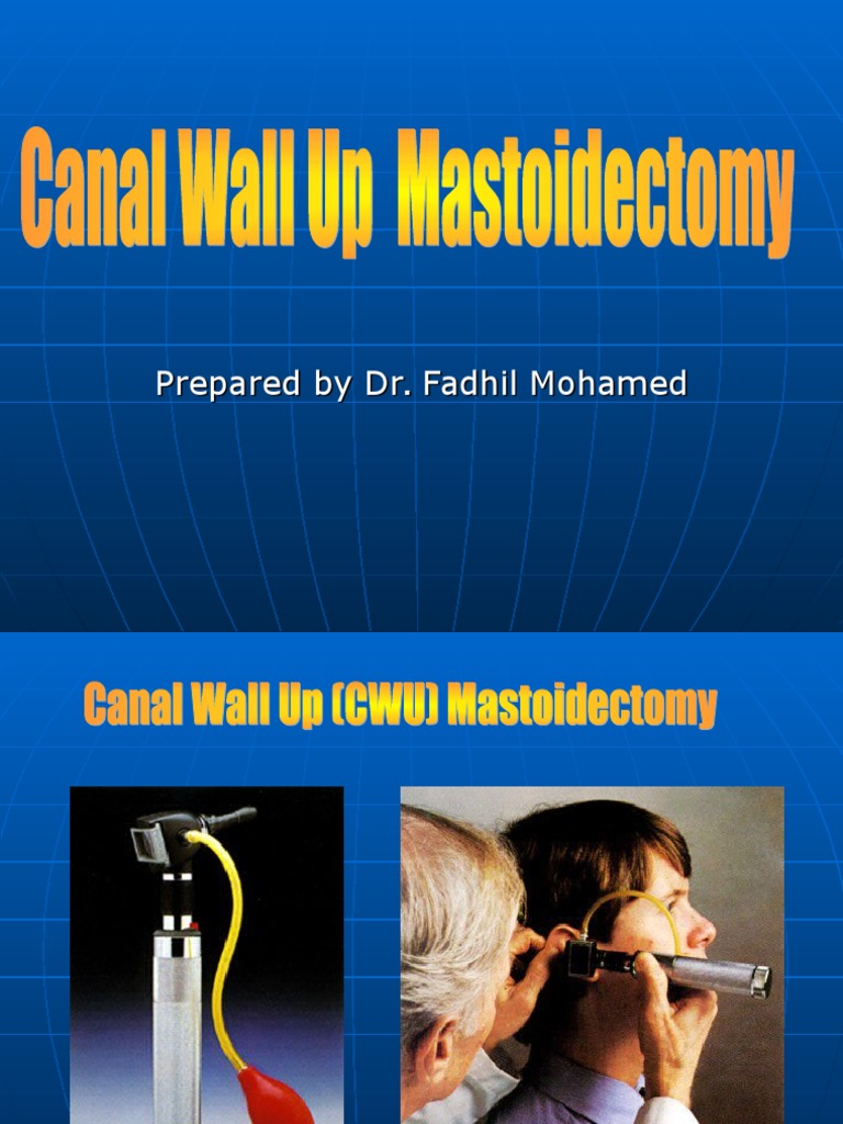 The Technique of Canal Wall Up Mastoidectomy: A Comprehensive Guide ...