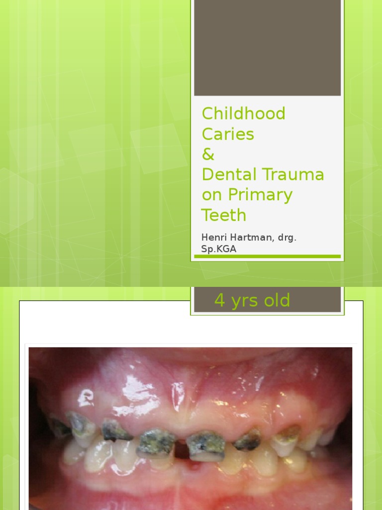 Childhood Caries & Dental Trauma On Primary Teeth: Henri Hartman, Drg ...