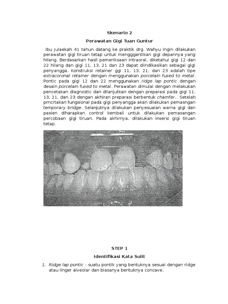 GTJ (Gigi Tiruan Jembatan) | PDF