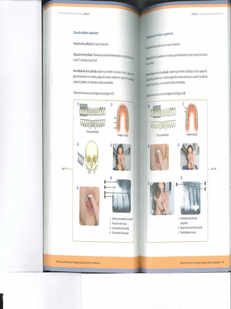 Manual Practico de Tecnologia Radiologia Dental y Maxilofacial | PDF