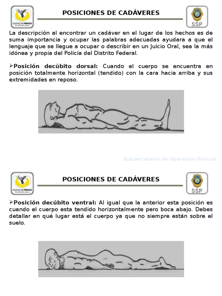 Posiciones De Cadáveres: Posición decúbito dorsal: Cuando el cuerpo se ...