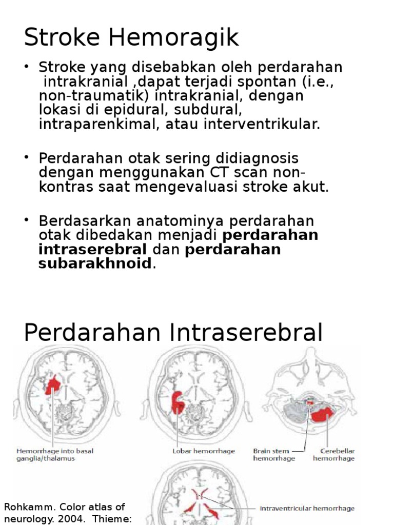 Anatomi, Patofisiologi, Gejala Klinis, dan Tatalaksana Stroke Hemoragik | PDF