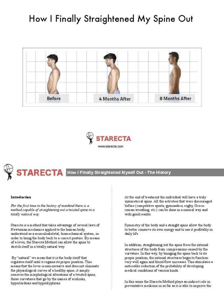 How Finally I Straightened My Spine Out | PDF | Scoliosis | Panic Attack