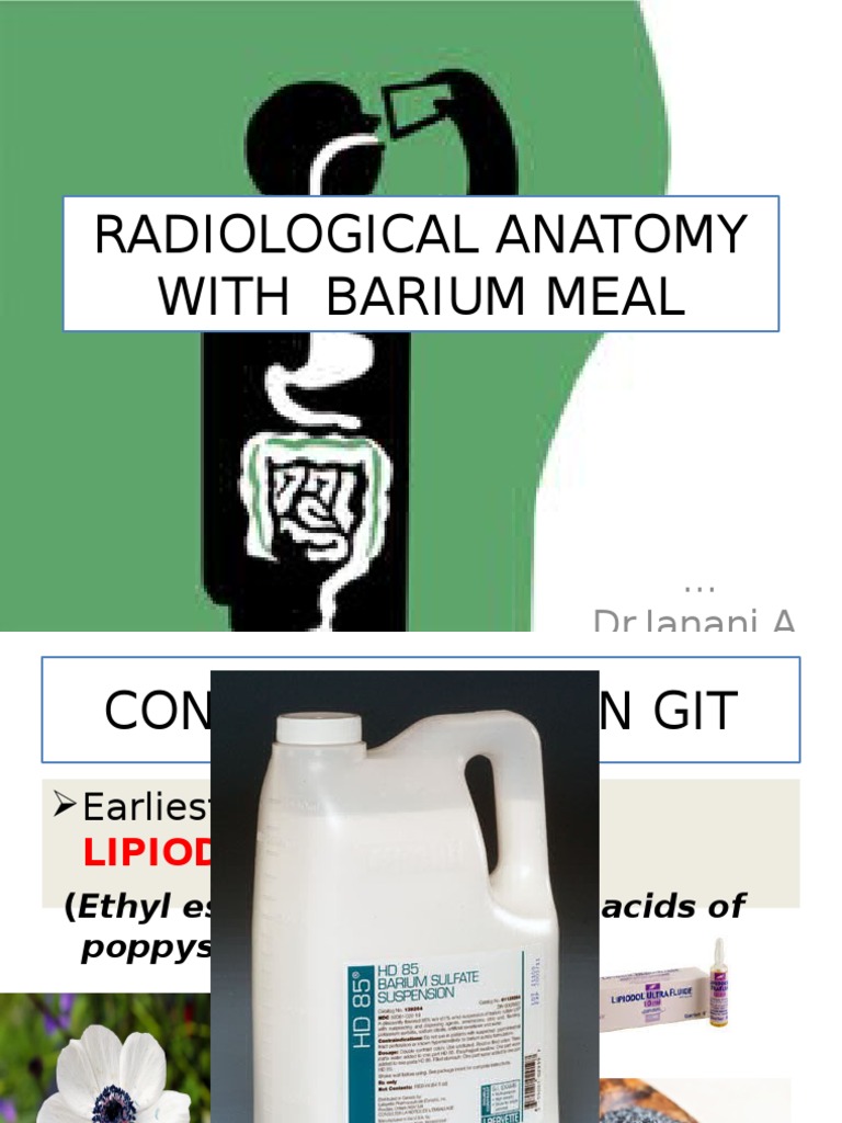 Radiological Anatomy With Barium Meal | PDF | Stomach | Peptic Ulcer