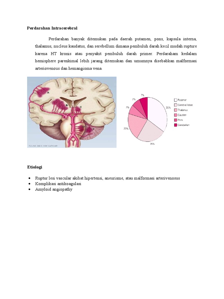 Perdarahan Intracerebral dan Subaraknoid | PDF