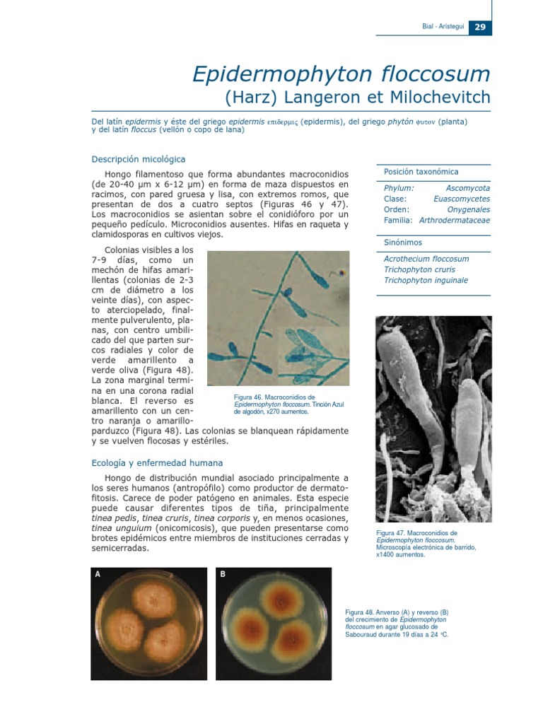 Características de Epidermophyton floccosum | PDF
