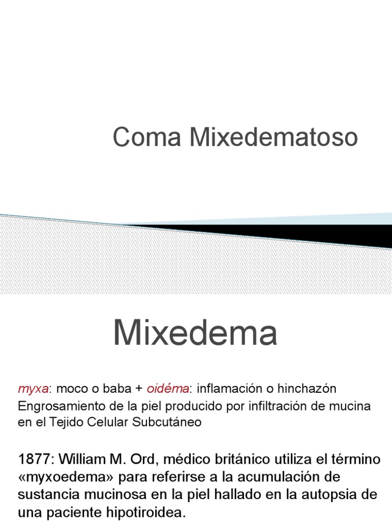 Mixedema | PDF | Hipotiroidismo | Tiroides