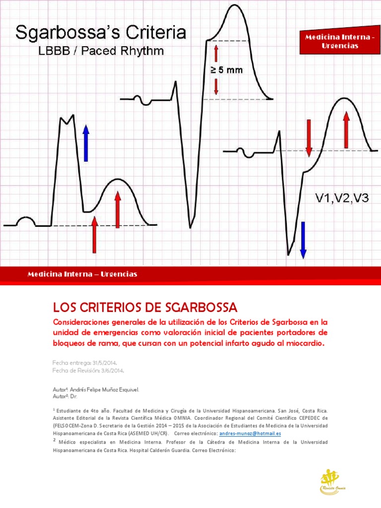 Sgarbossa criterios | Electrocardiografia | Electrofisiología cardíaca