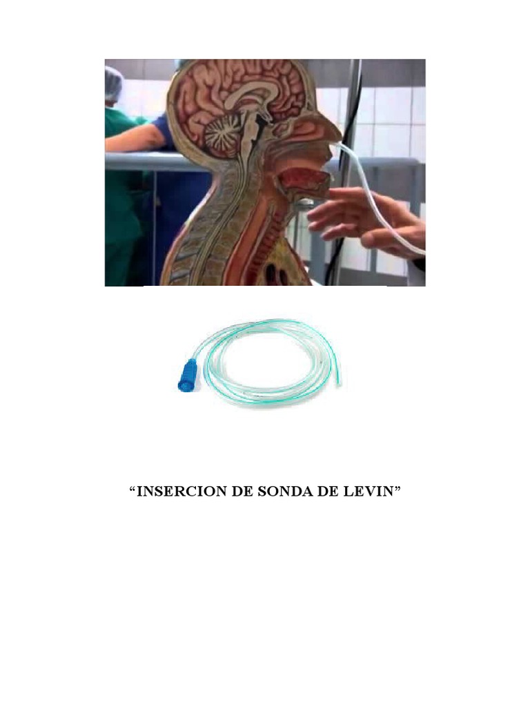 P-Colocacion de Sonda de Levin | PDF | Especialidades Medicas | Bienestar