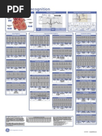 EKG Practice Test | PDF | Myocardial Infarction | Artificial Cardiac ...