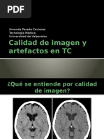 Pitch y TC Helicoidal | PDF | Ct Scan