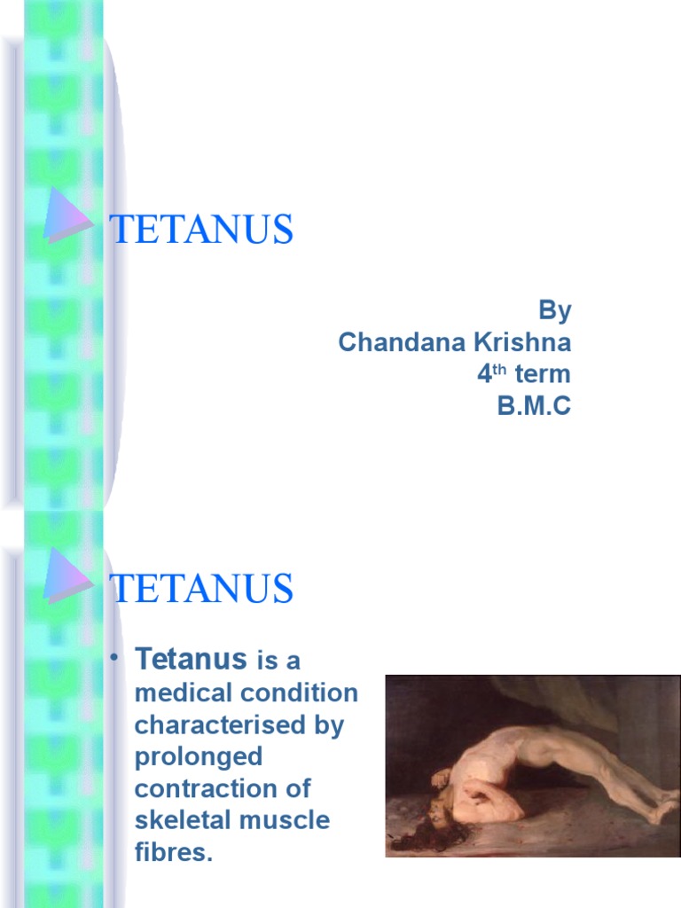 Tetanus | Microbiology | Medical Specialties