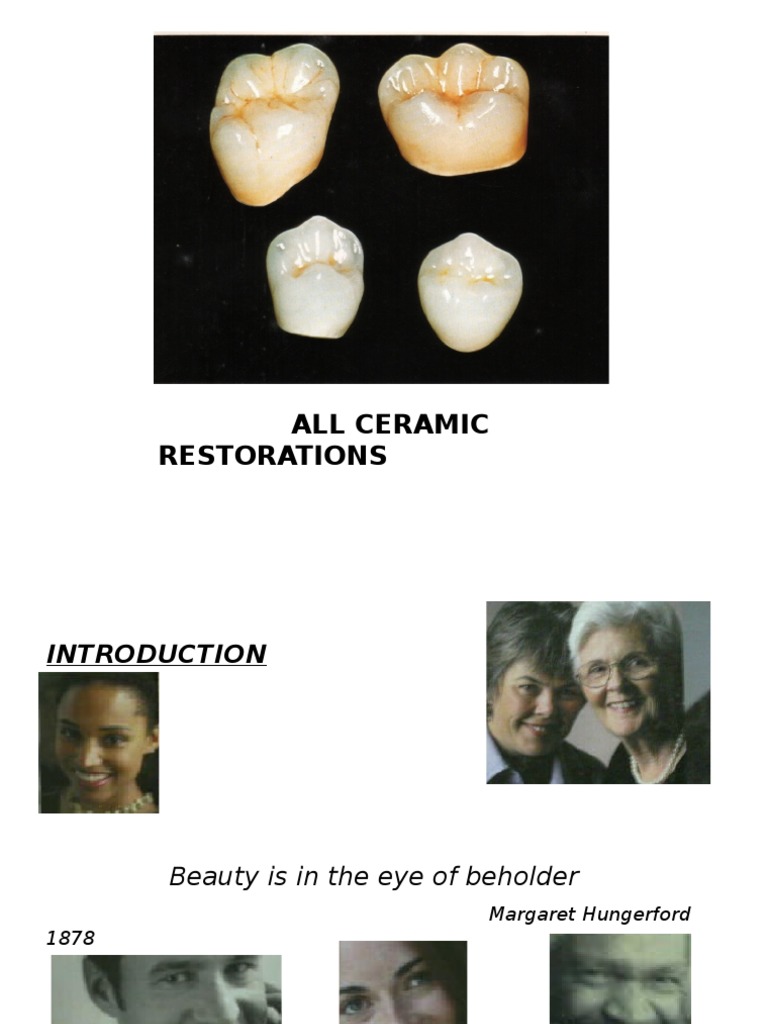 An Overview of All-Ceramic Restoration Systems: Materials ...