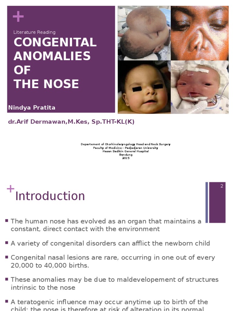 Congenital of The Nose | PDF | Human Nose | Otorhinolaryngology