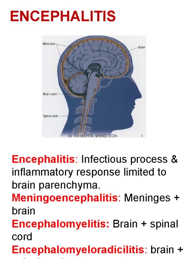 Encephalitis: 1 Dr. Rs Mehta, MSND, Con | PDF | Meningitis | Diseases ...