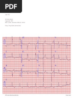 Ecg Made Ridiculously Easy! | PDF | Electrocardiography | Heart