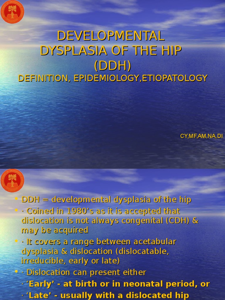 Understanding Developmental Dysplasia of Hip | PDF