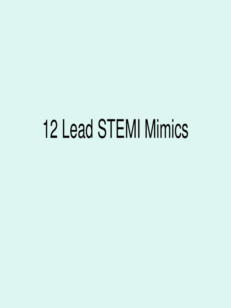 12 Lead STEMI Mimics | PDF | Electrocardiography | Myocardial Infarction