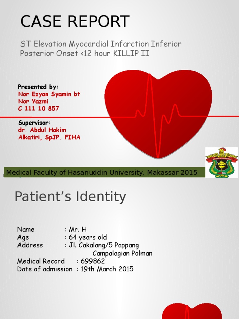 Inferior Posterior STEMI Case Report | PDF | Myocardial Infarction | Heart